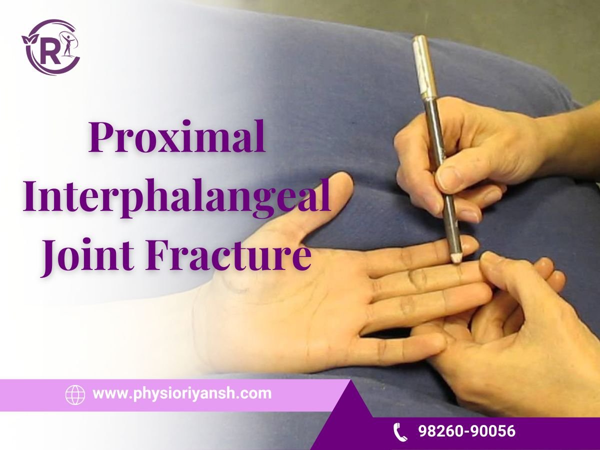 Proximal Interphalangeal Joint Fracture - RIYANSH PHYSIO